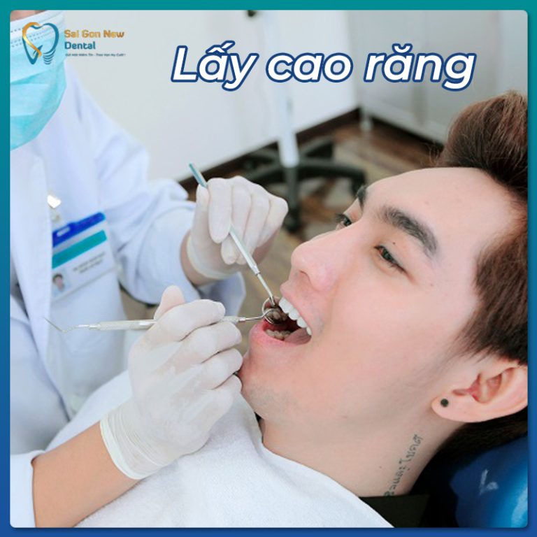 CẠO VÔI RĂNG - Nha Khoa Saigon New Dental